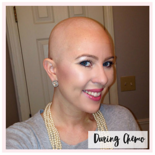 Post-Chemo Hair Growth Timeline | My Cancer Chic